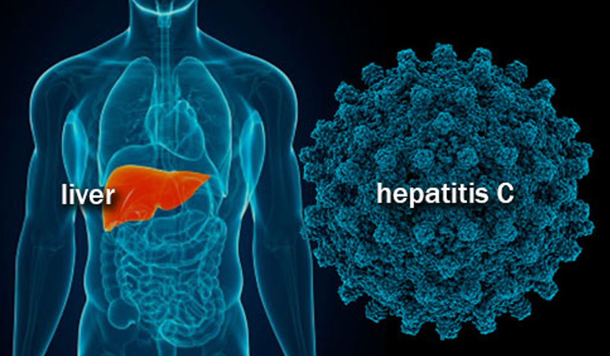 What you need to know about Hepatitis C - Medical India Tourism