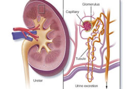 Optical Internal Urethrotomy (OIU) in India | Medi Connect India