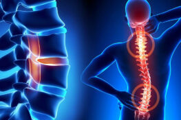 Optical Internal Urethrotomy (OIU) in India | Medi Connect India